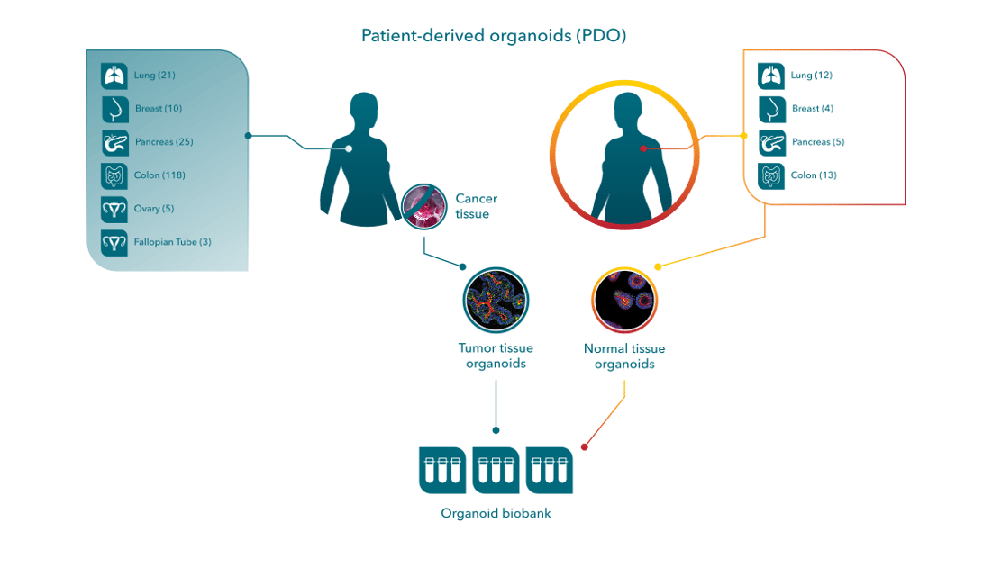 Organoids for Oncology Drug Development